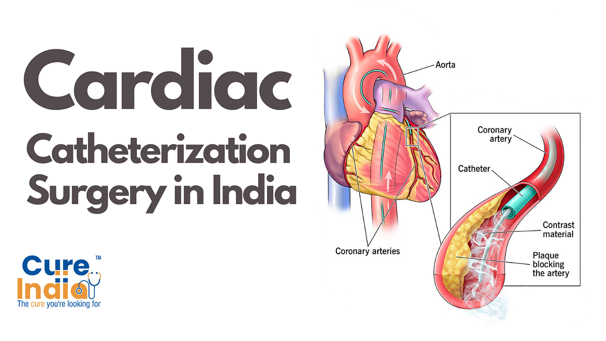 Cardiac Catheterization: A minimally invasive procedure for diagnosing ...