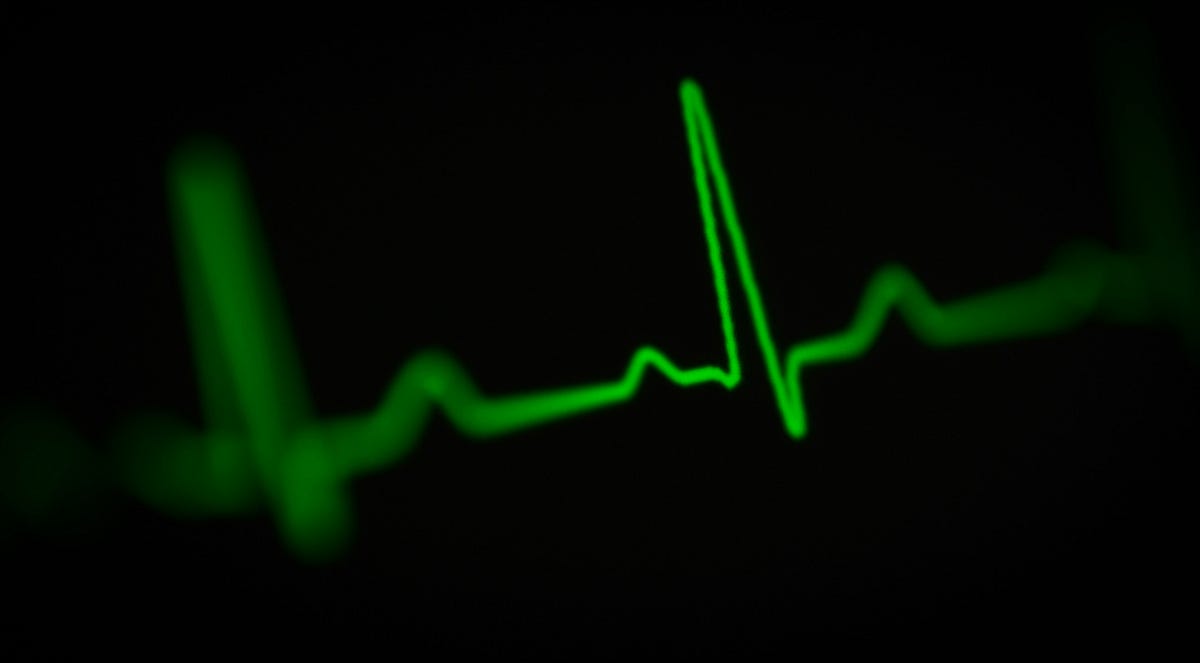 The Weight of a Heartbeat. Distinguishing the Rush of Desire from… | by ...
