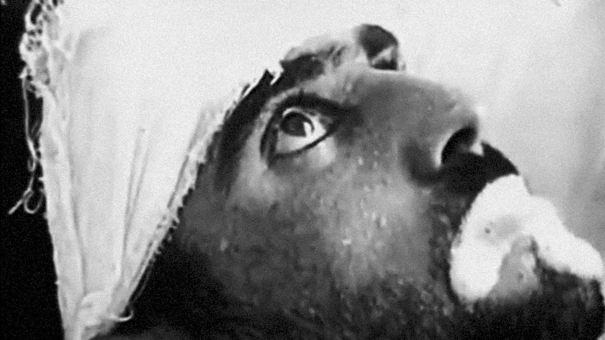 Rabies. The scariest disease to ever exist? | by Samyak Mahapatra | Medium