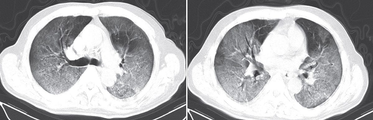 “If you can’t stop AI — lead it”: interview with a radiologist who became a consultant at a ...