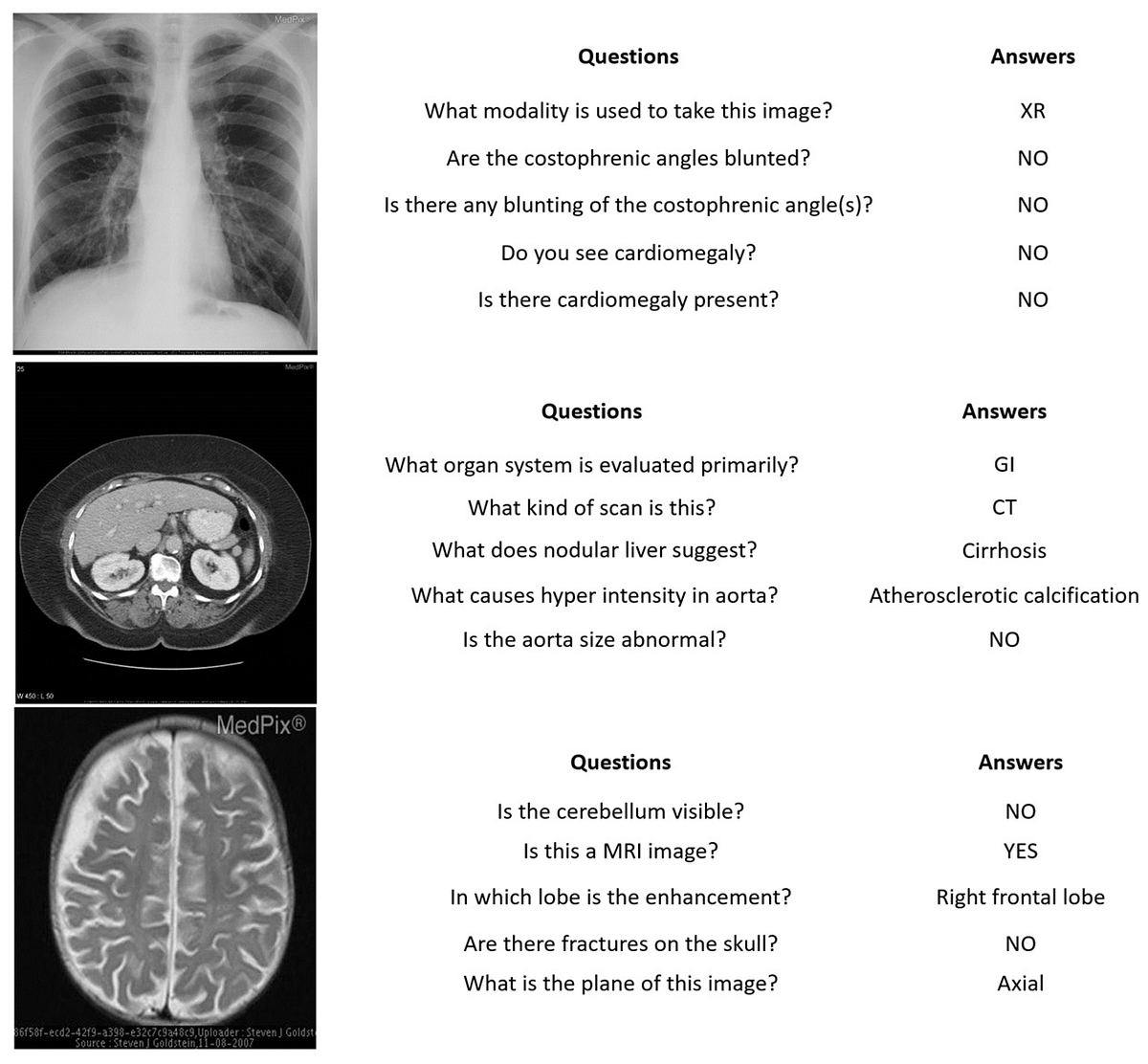 Vision Langauge Models (VLM) in Medicine: A Review | by Abdulkader Helwan | Artificial ...