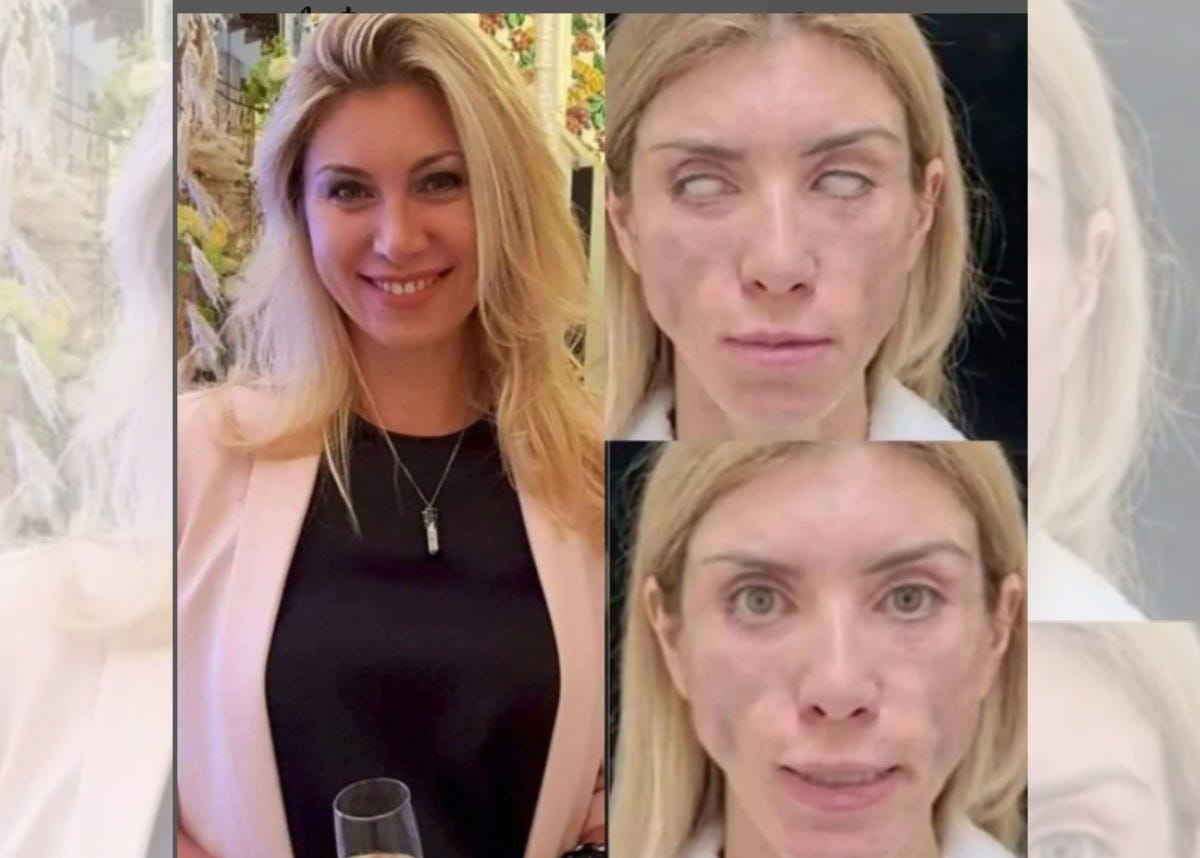 Florida’s Plastic Surgery Scam: Unlicensed Practitioners Cause Real ...