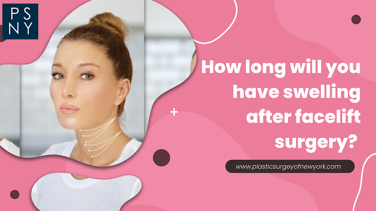 How Long Will You Have Swelling After Facelift Surgery? - Plastic ...