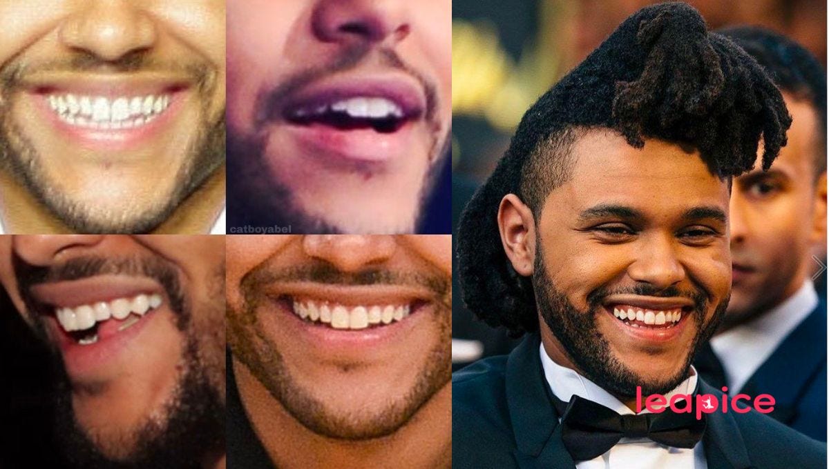 The Weeknd Old Teeth: A Reminder That Imperfection Is Beautiful | by ...