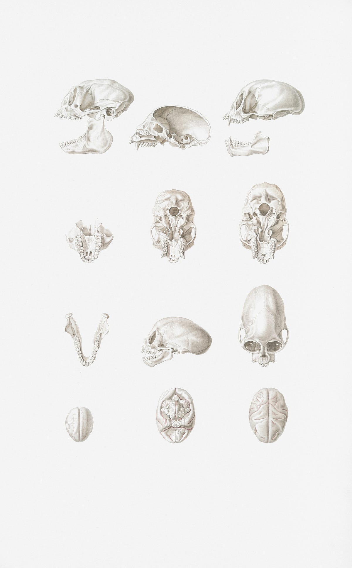 Bone Pathologies in Forensic Anthropology | by Suat Dinç | Medium
