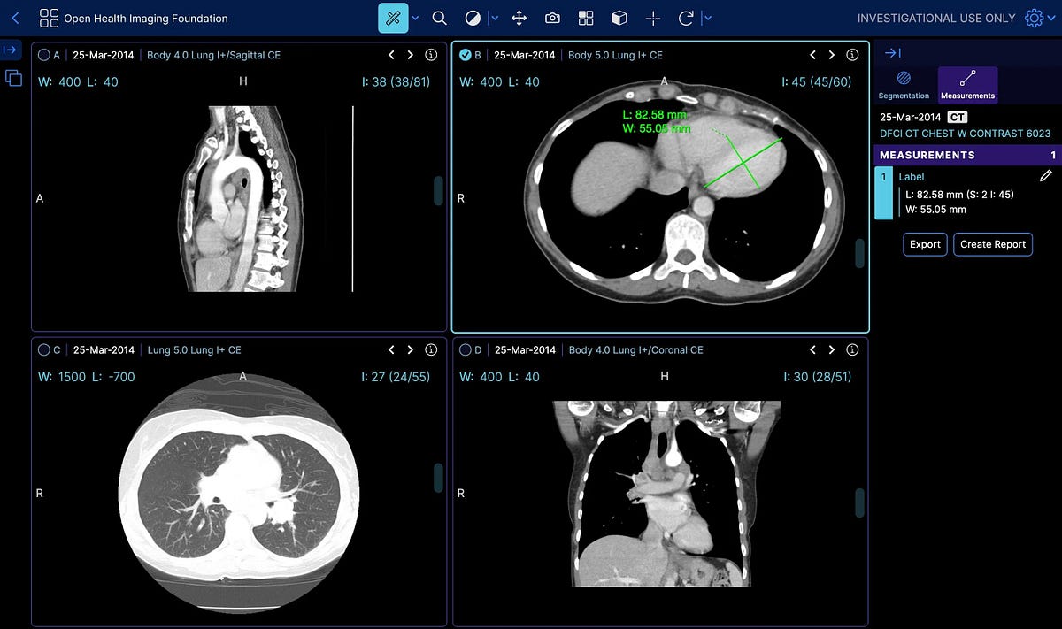 Easy Peasy Medical Imaging with OHIF | by Mohammed El Amine Mokhtari ...