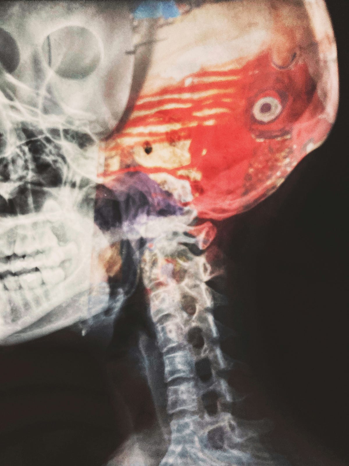 Brain Rot is Ruining Your Lives :In 1 Min - The Shortform - Medium