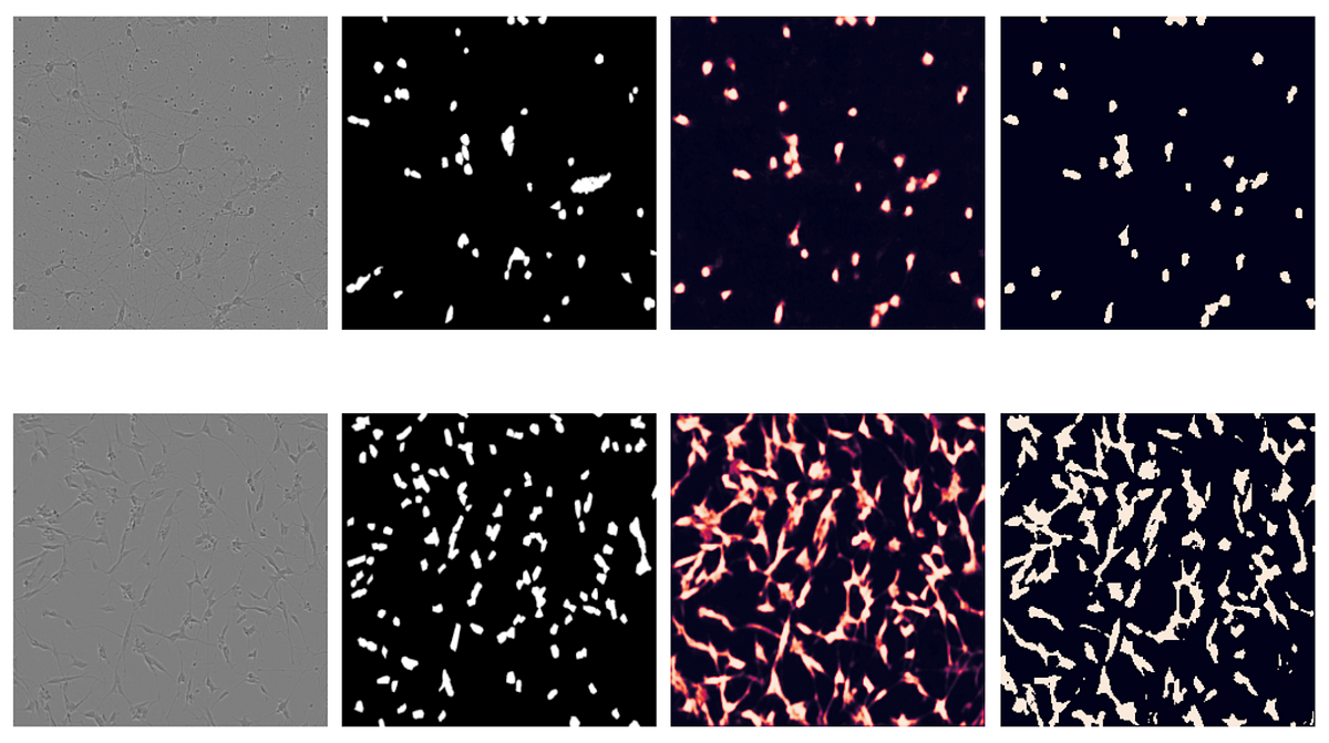 Cell instance segmentation. This study project was a part of… | by Ekaterina Sedykh | Medium