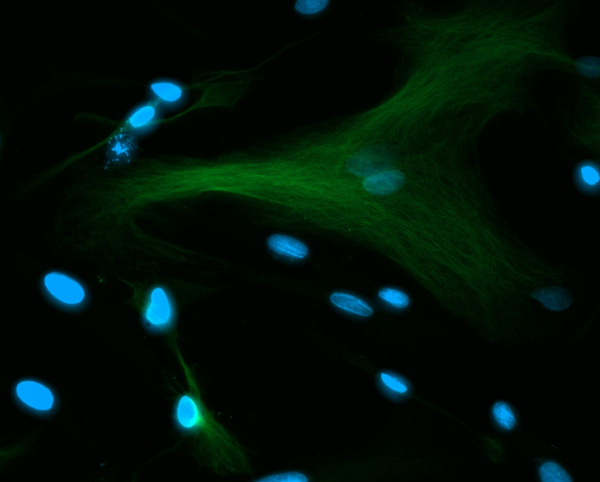 Knowledge Graphs Meet LLMs: Comparative Analysis of GraphRAG, LLM, and ...
