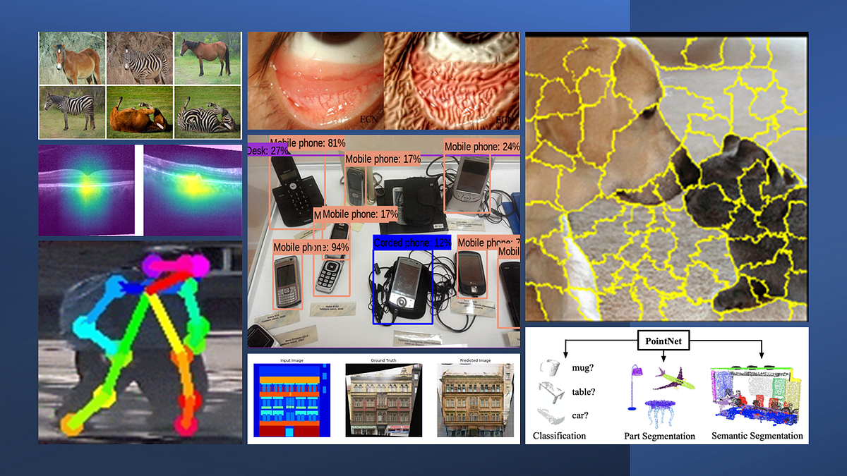 Top 10 Projects for Beginners in Computer Vision and Medical Imaging ...