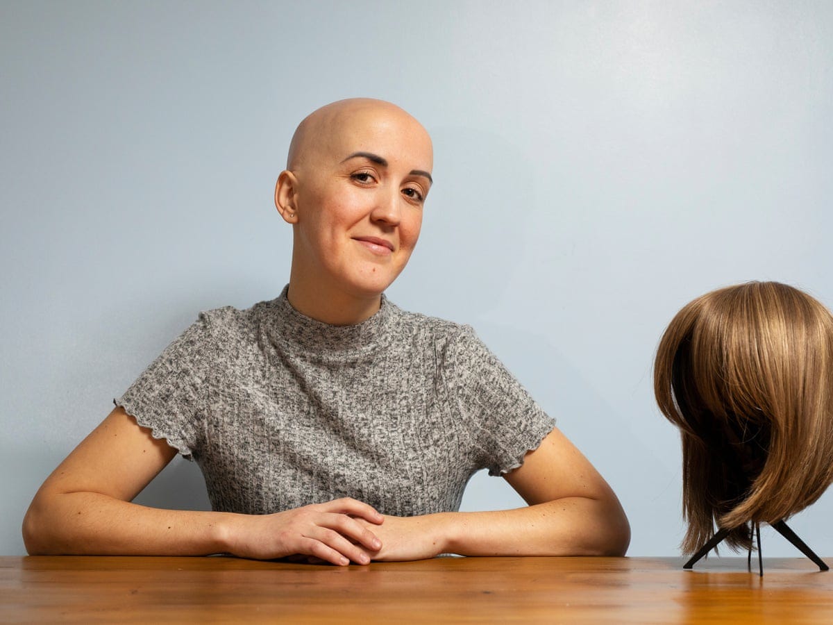 Women go bald too, you might be surprised why | by Chantal Cooper | Oct ...