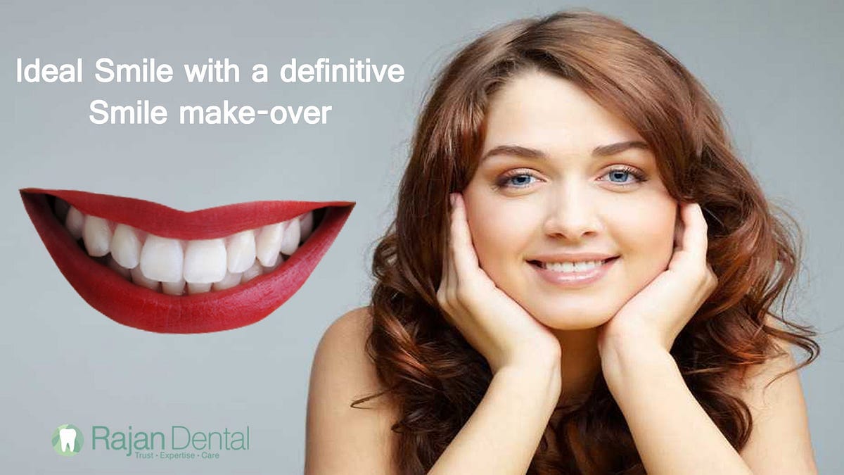 Ideal Smile with a definitive Smile make-over | by Ranjitha | Medium