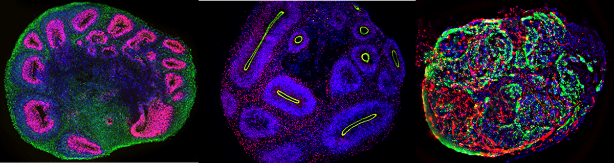 Mini Organs in a Dish: The Promise and Ethics of Organoids 🧠 → 🧫 | by ...