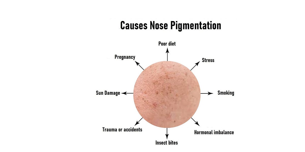 How do you fix pigmentation on your nose? | by Dermorita clinic | Apr ...