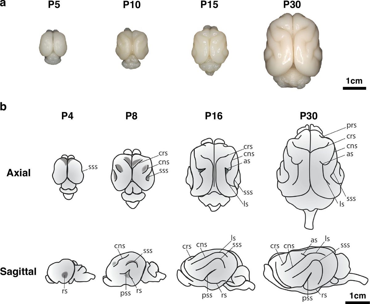 Unraveling the Biophysical Basis of Brain Folding and Misfolding in ...