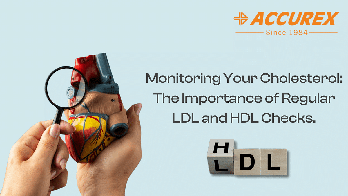 Monitoring Your Cholesterol: The Importance of Regular LDL and HDL ...