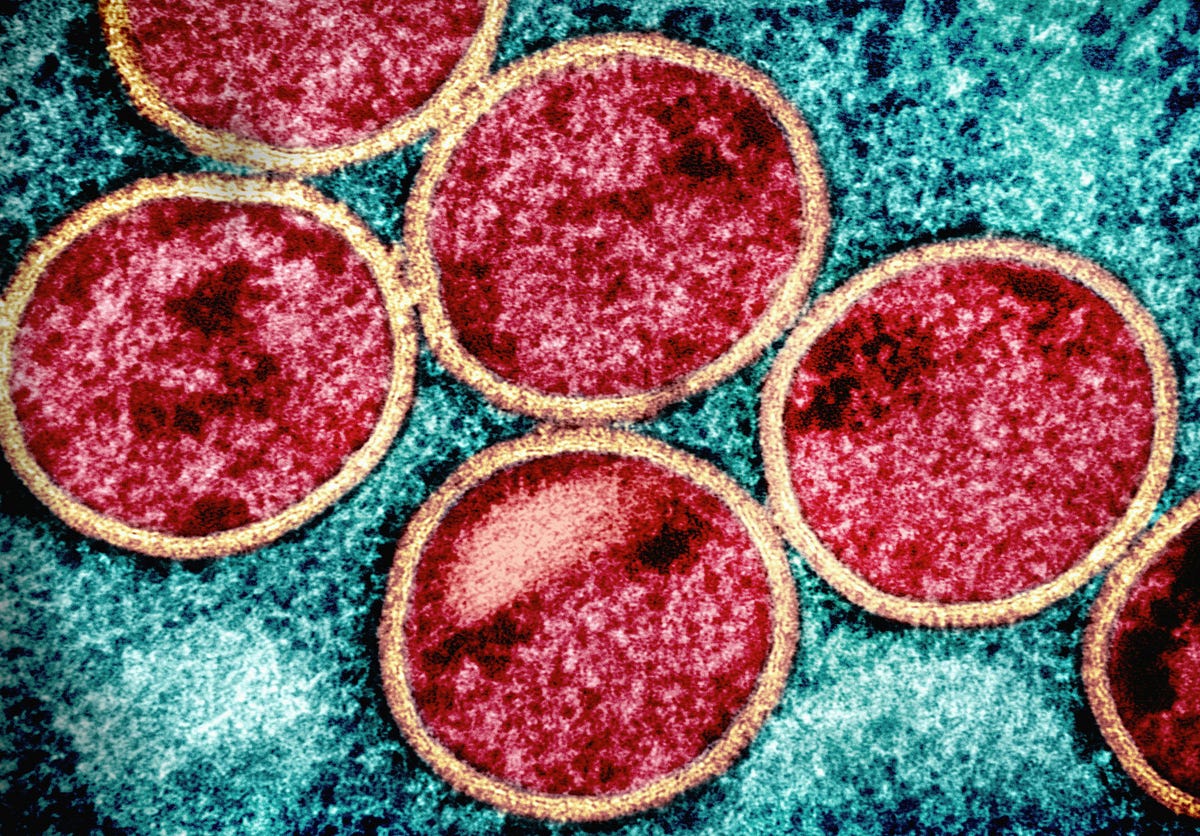 Mpox Outbreak What You Need To Know About The New Clade I Variant By Tyreana Broome Aug