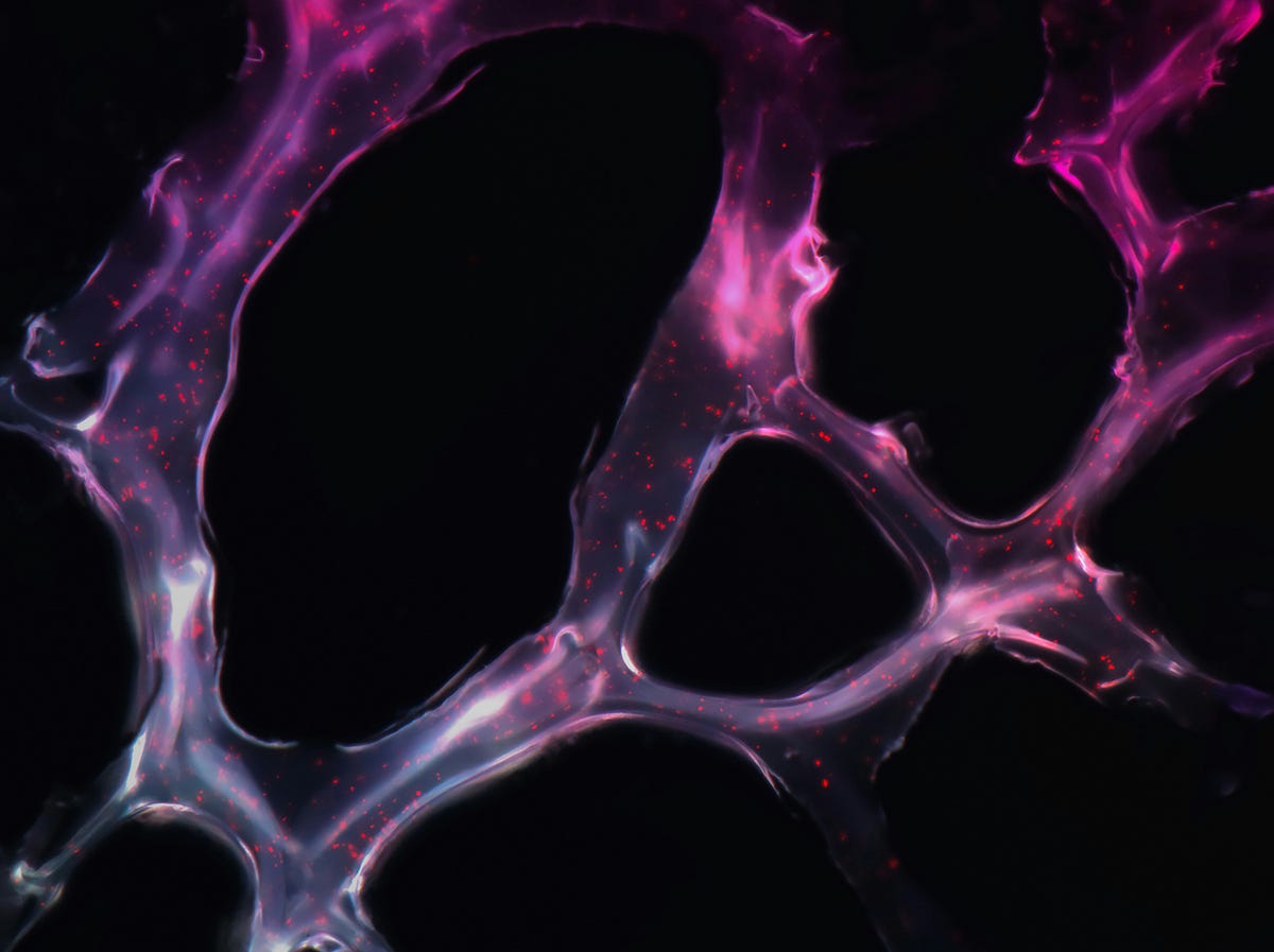 Predicting Cancer with Support Vector Classifier Model | by Deon Gideon | EachSecondAI | Medium