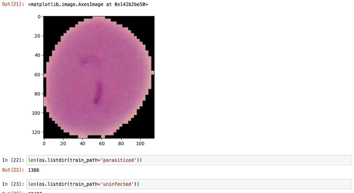 Analysing the Impact of Imbalanced Datasets on CNN-Based Malaria Cell ...