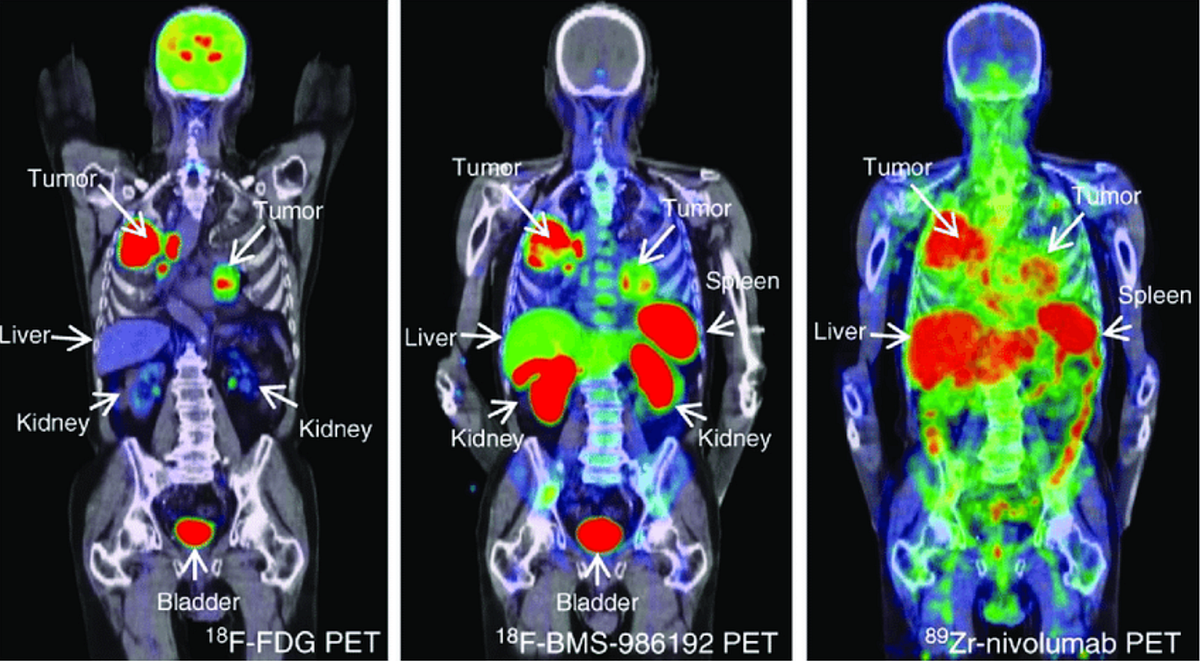 7. The use of Nuclear Technology in treating cancers resulting from ...