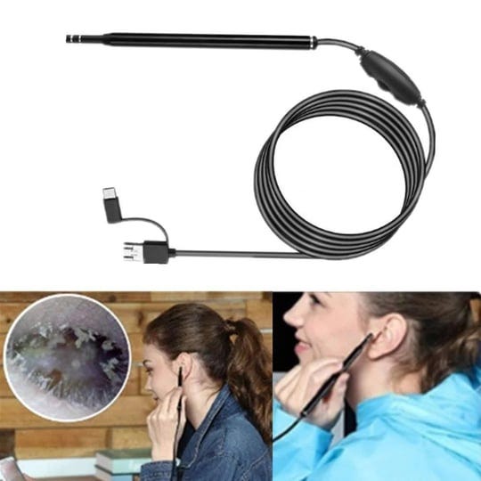 Ear Scopes | by Stephen Stone | Jul, 2024 | Medium