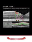 Atlas of OCT: Retinal Anatomy in Health & Pathology By Neal Adams View ...