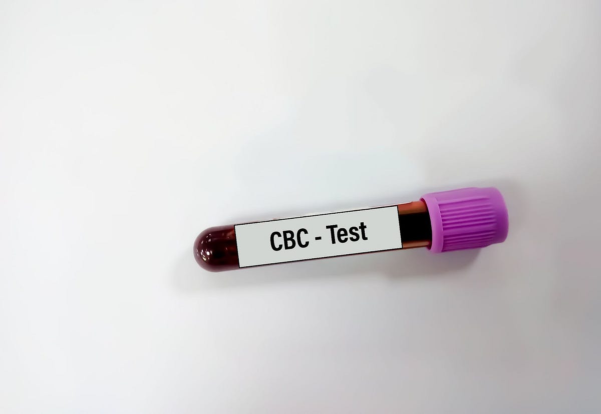 5 Preventive steps to keep your white blood cells (WBC) count normal ...