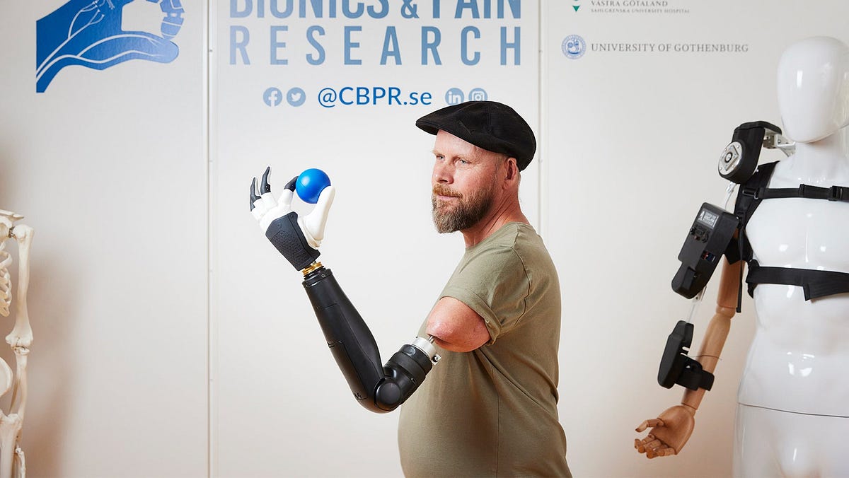 Why Your Next Hand Could Feel Real: The Tech Behind Haptic Prosthetics ...