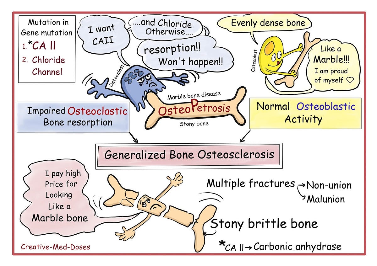 Osteopetrosis — Know It All!. All you need to know about Marble Bone ...