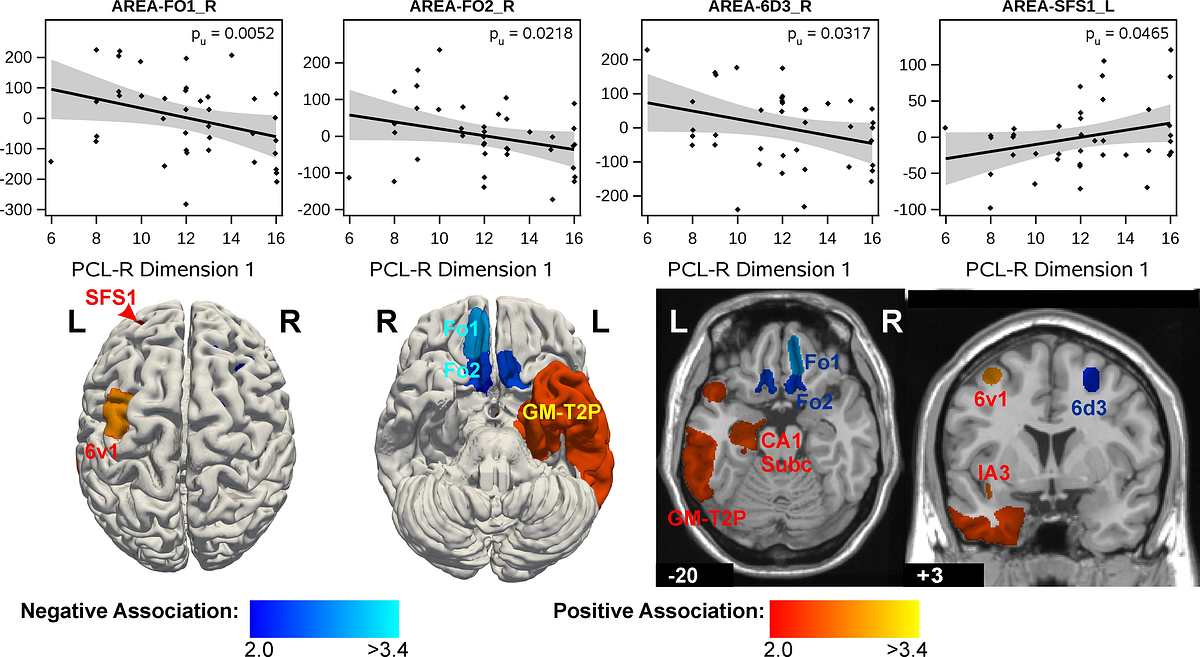 The Neural Blueprint of Psychopathy: Unraveling the Brain Networks ...