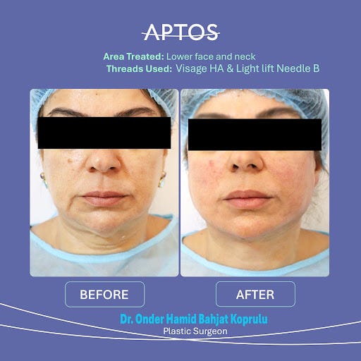 Aptos: Leading Aesthetic Evolution with Innovation, Quality, and ...