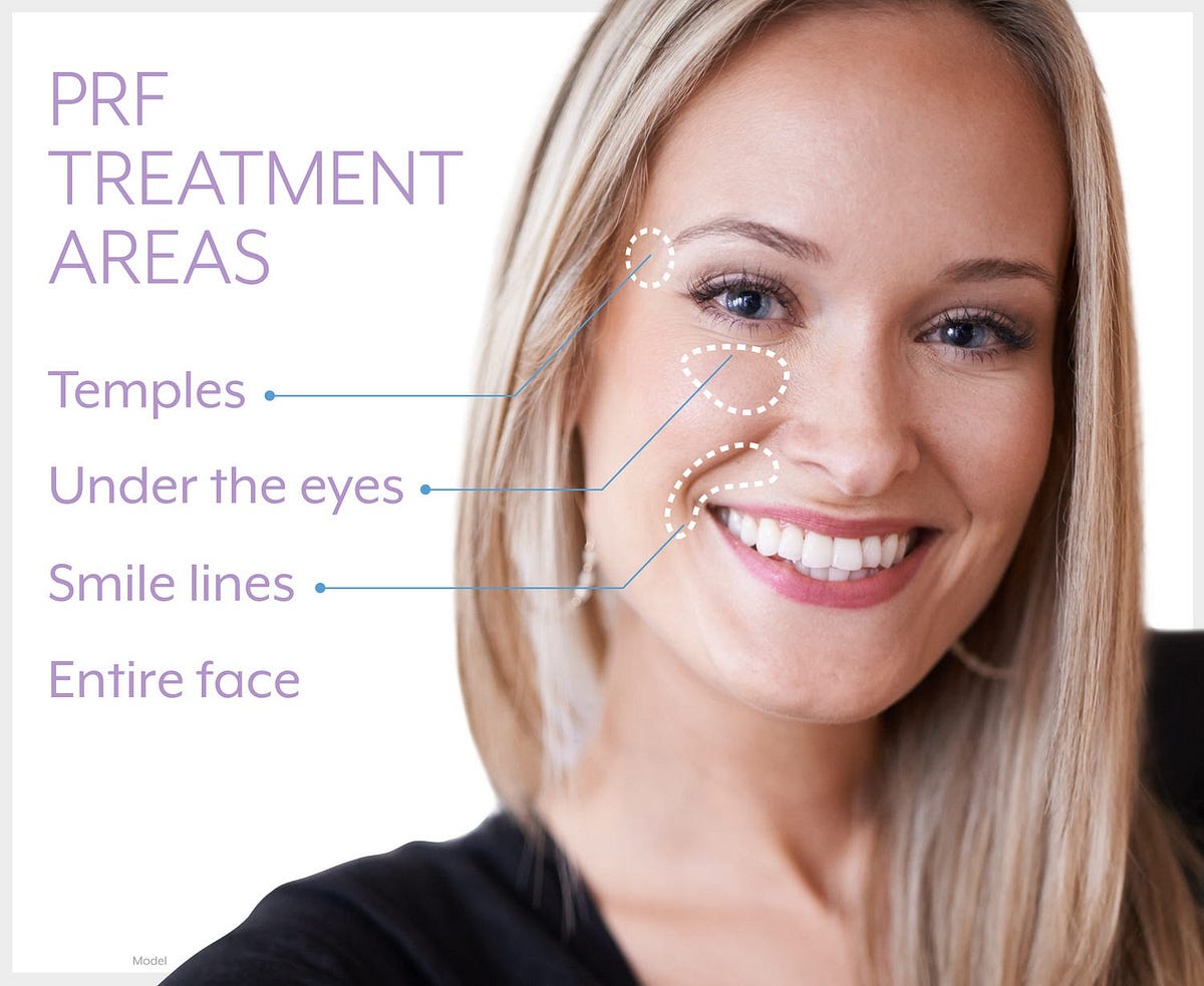 Choosing the Right PRF Treatment in Sarasota | by Careesthetics | Medium