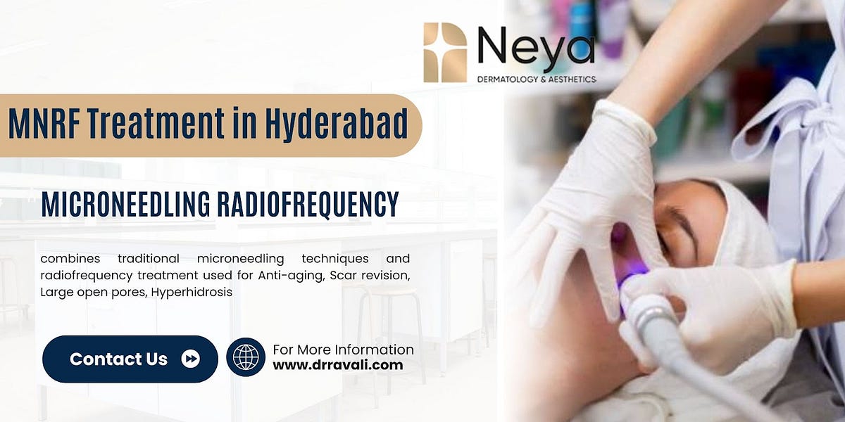 MNRF Treatment For Acne Scars. Microneedling radiofrequency (MNRF ...