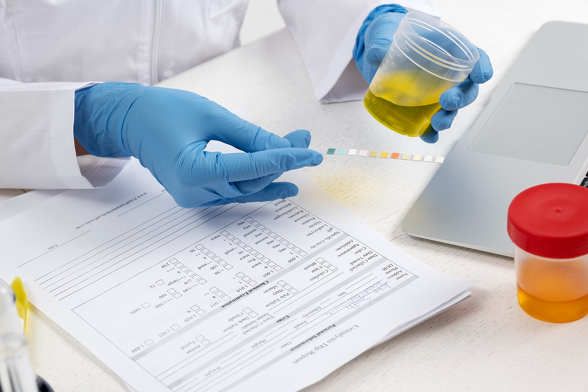 Everything you need to know about urinalysis: Physical, chemical ...