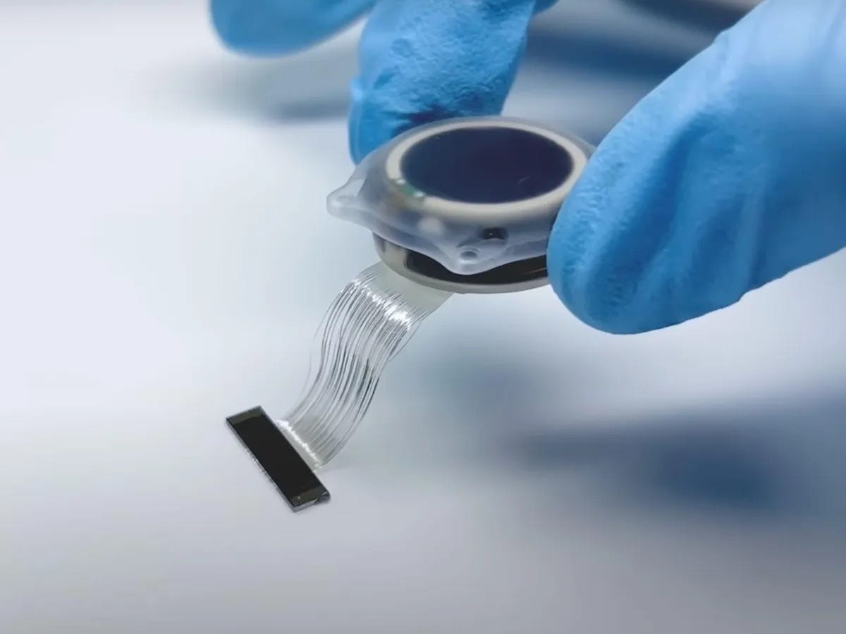 The Brain Chip Revolution: What You Need to Know on Elon’s Neuralink ...