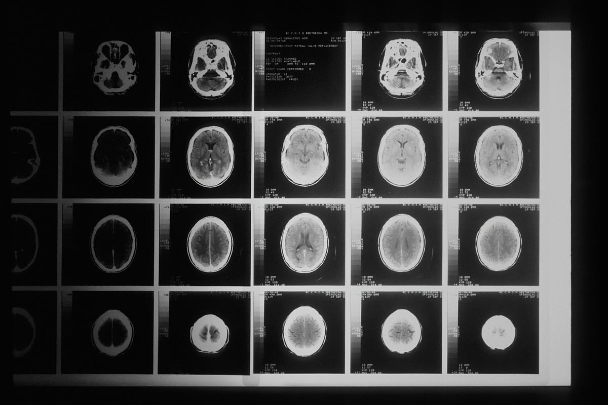 The Neuroscientist Who Found Out He Had the Brain of a Psychopath | by ...