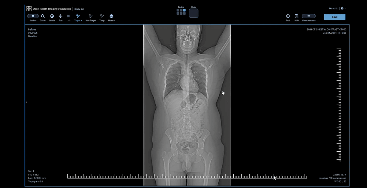 How to Get Involved With Open-Source Health Care Software | by Danny ...