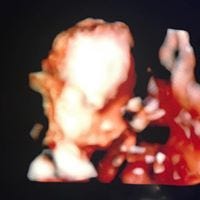 About – Rachel Franzen – Medium