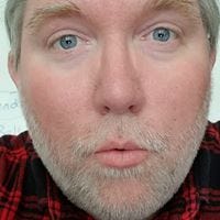 Bill Kilpatrick – Medium