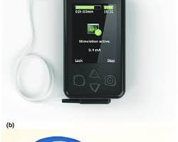Vagus Nerve Stimulation Devices?. Are there Transcutaneous Auricular ...