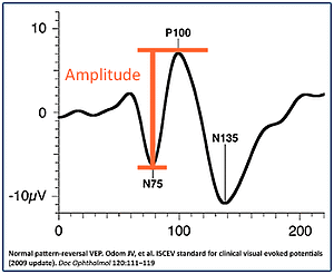 What do I see on this VEP? A Quick Waveform Review | by Caitlin D ...