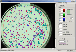 Mastering Microbiology: How to Use a Colony Counter to Enhance Accuracy ...