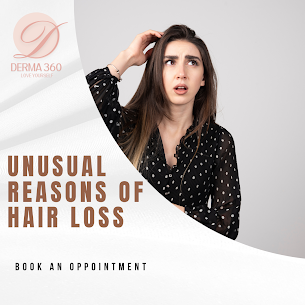 Regain Your Confidence with Advanced Hair Fall Treatment at Derma 360 ...