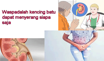 Mengenali Gejala Kencing Batu Beserta Cara Pengobatan Herbal | by ...