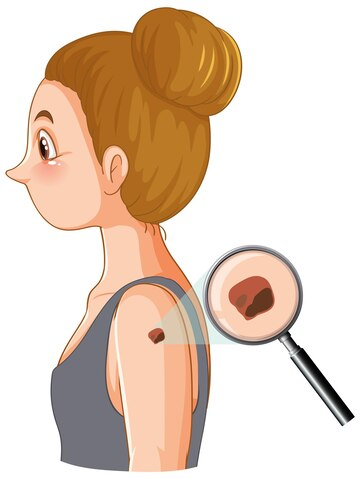 Understanding Skin Damage and the Importance of Regular Skin Cancer ...