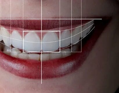 The Technology Behind Digital Smile Designing: Tools and Techniques ...