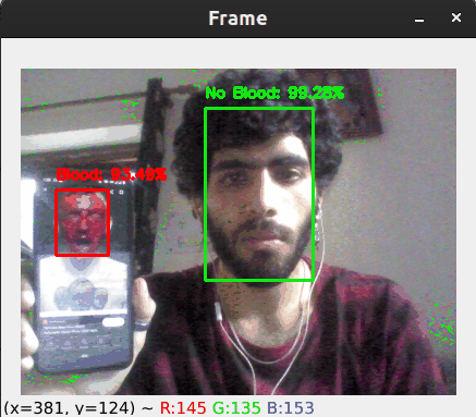Blood Face Detector in Python (Part-1) | by Mrinal Walia | Artificial ...