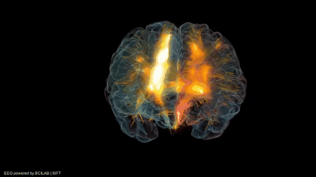 TBI: Brain Fatigue!. Sensations of the Brain — Fatigue | by MicheleElys ...