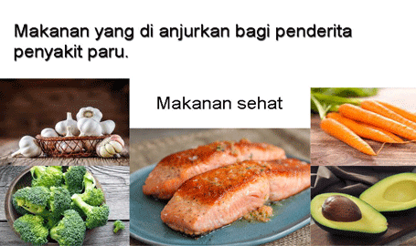 Ada Beberapa Macam Gejala Paru Yang Perlu Di Ketahui | by maulida amoy ...