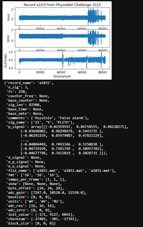 [訊號處理] wfdb-python 讀取訊號. wfdb-python | by Evelyn | 趨近於無限大 | Medium